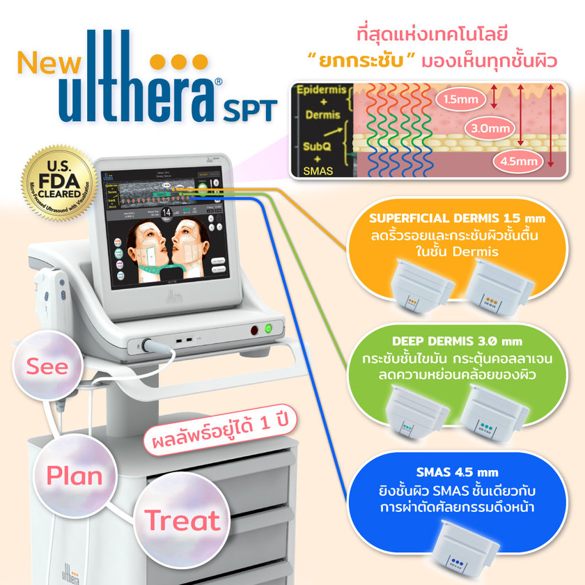 รู้จัก Ulthera SPT นวัตกรรมยกกระชับหน้าให้เรียวแบบไม่ต้องเจ็บตัว ไม่ต้องผ่าตัด